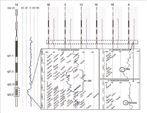 Array Based Cgh Data Showing Deletions Between Erg And Tmprss2 In