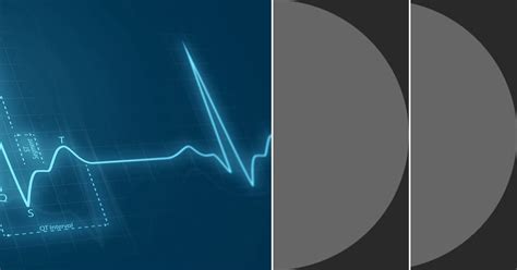 List Time Series Transformer Curated By Migliorabile Medium