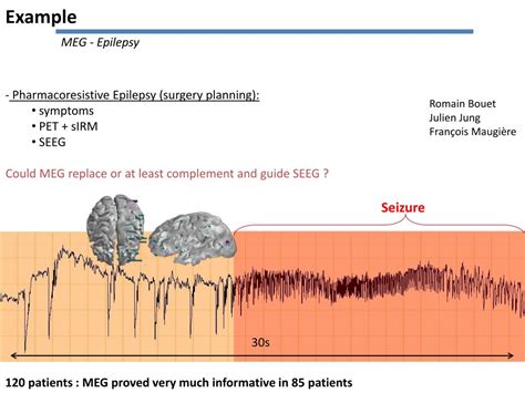ppt meg eeg inverse problem and solutions in a bayesian framework