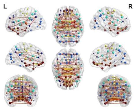 How To Visualize Connectivity In 3d Brain Support And Discussions