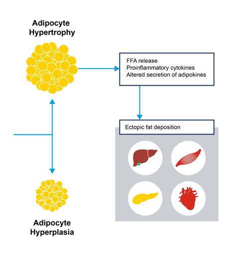 Obesity Is A Disease Pathophysiology