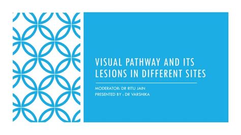 Visual Pathway And Lesions In Different Sites Of Visual Pathway Pdf