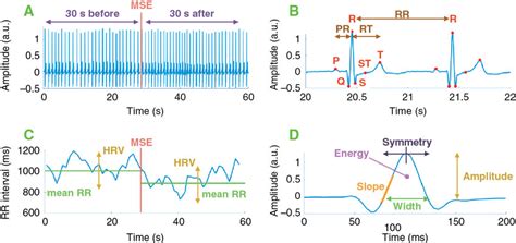 Signal Processing Work Flow For Feature Extraction A Manually Download Scientific Diagram