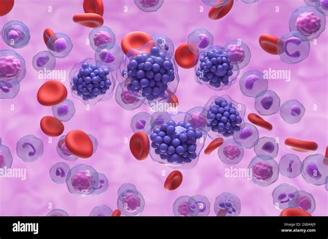 Diffuse Large B Cell Lymphoma DLBCL Isometric View D Illustration