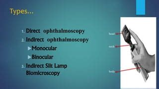 Direct Ophthalmoscopy Final Pptx