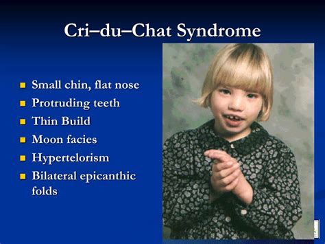 Ppt Common Chromosomal Abnormalities Powerpoint Presentation Free