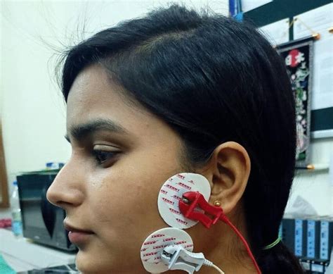 Setting Of Bipolar Electrodes On Human Subject During An Download