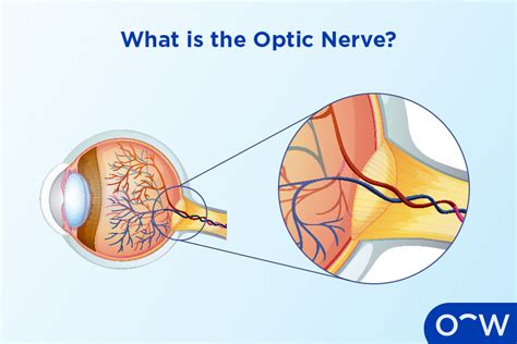 Optic Nerve Anatomy Function And Related Eye Problems