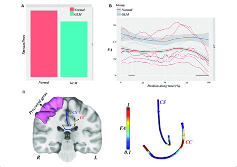Along Tract Statistical Analyses Showing Significantly Lower Download Scientific Diagram