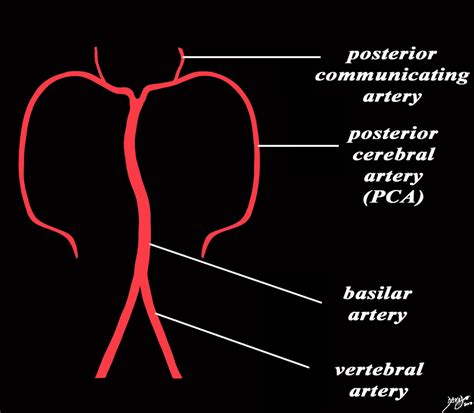 Posterior Communicating Artery The Common Vein