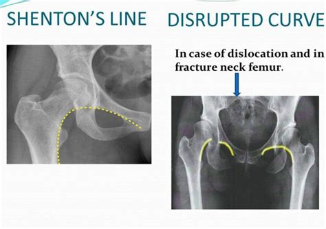 Shentons Line Medizzy