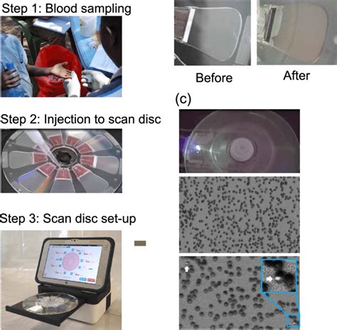 Process For Malaria Diagnosis Using The Automated Malaria Diagnostic Download Scientific