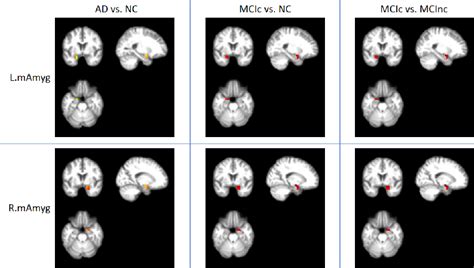 Figure 14 From Adaptive 3dcnn Based Interpretable Ensemble Model For
