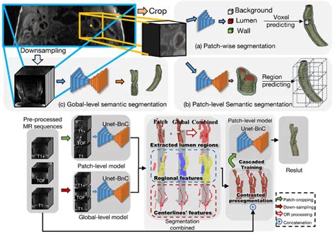 cascaded residual u net for fully automatic segmentation of 3d carotid