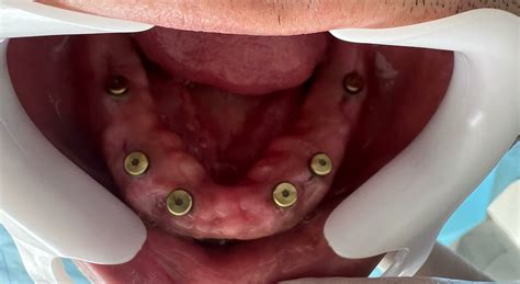 گالری تصاویر دکتر میلاد محمدی