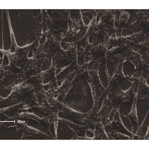 Cell Morphology In Scanning Electron Microscopy Sem Of 3t3 Fibroblast