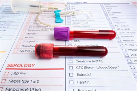 How To Understand Your Serology Test Report A Complete Guide