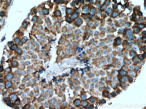 Ythdf2 Antibody 24744 1 Ap Proteintech