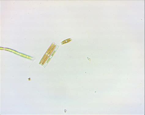 Bacillariophyceae Diatoms Under Microscope Phot Tomasz Garbowski