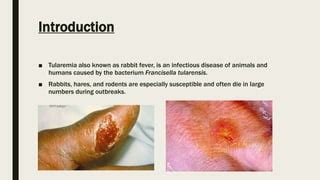 What Is Tularemia