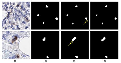 Visualization Of The Effect Of Post Processing Method Using Two