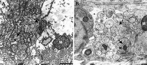 Morphology Of Classical Fixation Of C Elegans Tissues Vs High Pressure
