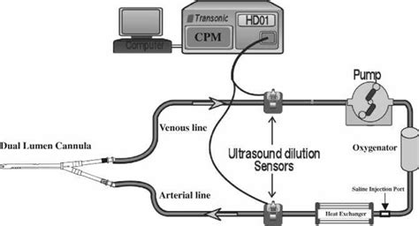 Schematic Of The Vv Ecmo Circuit Interfaced With Ultrasound Dilution Download Scientific