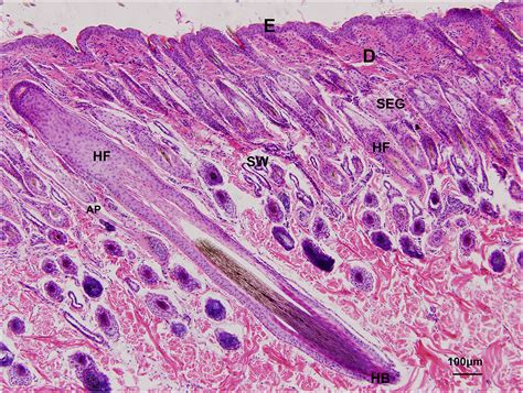 Dermal Papilla Histology