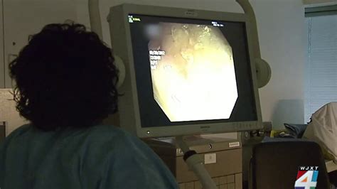 AI Being Used To Detect Deadly Polyps YouTube