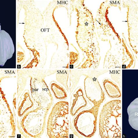 The Aortic Sac And Oft Of The Human Embryonic Heart At Cs15 The Aortic Download Scientific