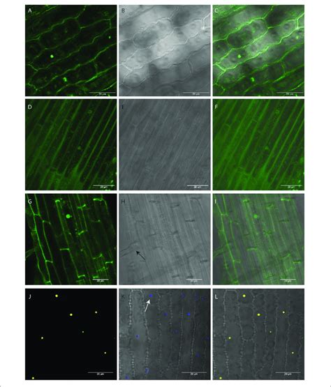 Transient Expression Of Psite 2ca Empty Gfp Vector Construct And