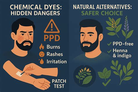 How To Avoid Beard Dye Burns And Rashes Bohemian Kings Uk