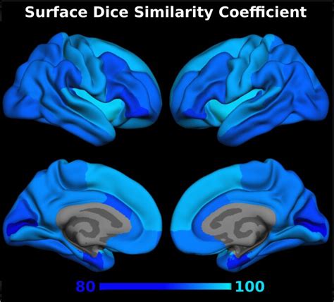 Fastsurfer A Fast And Accurate Deep Learning Based Neuroimaging Pipeline Deepai