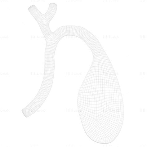 Gallbladder With Gallstones 3d Model