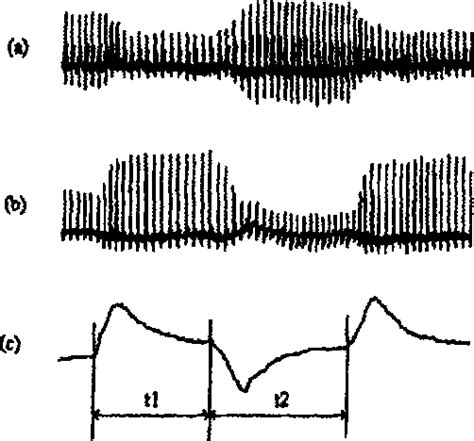 Figure 1 From Derivation Of Respiration From Electrocardiogram During Heart Rate Variability