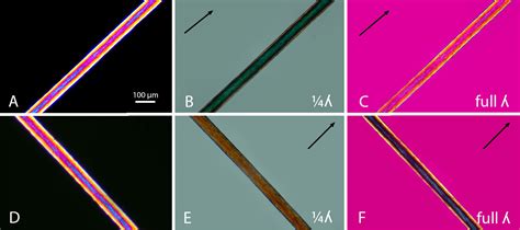 Birefringence Using A Motic Polarizing Microscope And The Michel Lévy