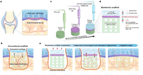 Figure 1 From Enhanced Osteochondral Regeneration With A 3d Printed