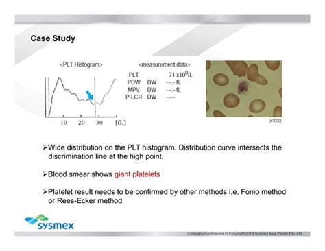 Histogram Interpretation For Result Analysis Pdf Histogram Interpretation For Result Analysis Pdf