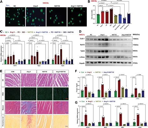 Nat10 Is Involved In Cardiac Remodeling Through Ac4c Mediated Transcriptomic Regulation