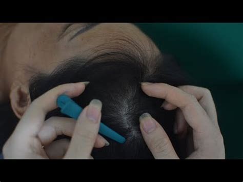 ASMR Scalp Massage,Tingles Scalp Scratching No Talking, Therapy Sounds ...