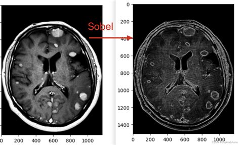 Opencv轻松入门(八)——图片卷积 Opencv轻松入门(八)——图片卷积