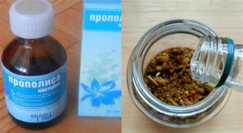 ერთადერთი პროდუქტი რომელიც ანადგურებს ბაქტერიებს ვირუსებსა და სოკოს ერთდროულად აუცილებლად