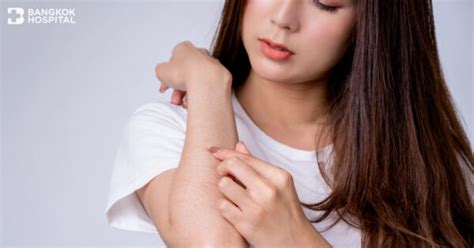 Morphea A Skin Condition That Can Be Detrimental To Your Self