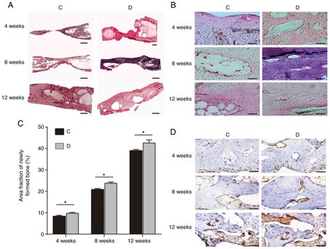 Autogenous Bone Particles Combined With Platelet‑rich Plasma Can Stimulate Bone Regeneration In