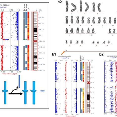 Cytogenetic And Snp Array Results Of Upd Combined With Chromosomal Download Scientific Diagram