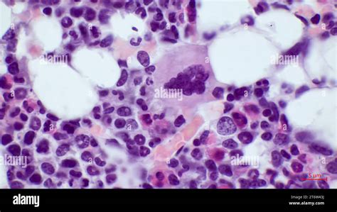 Bone Marrow Histology