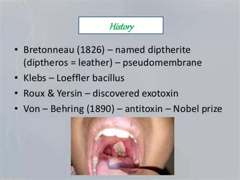Corynebacterium Diptheriae Ppt