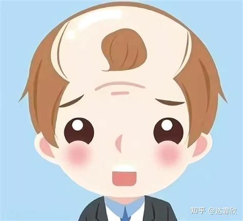 面对不同部位的脱发！！！怎么做会缓解？ 知乎