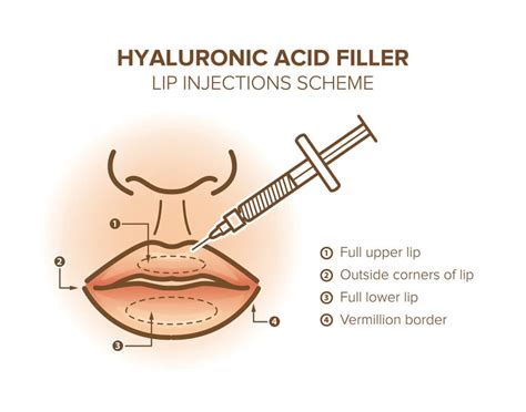 Guide To Lip Fillers Treatment In Singapore Price Cost And Faqs