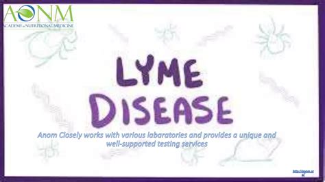 Lyme Disease Testing Ppt